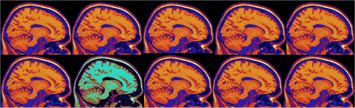 Deafness and Neural Plasticity Lab – Velia Cardin's Lab. Brain ...